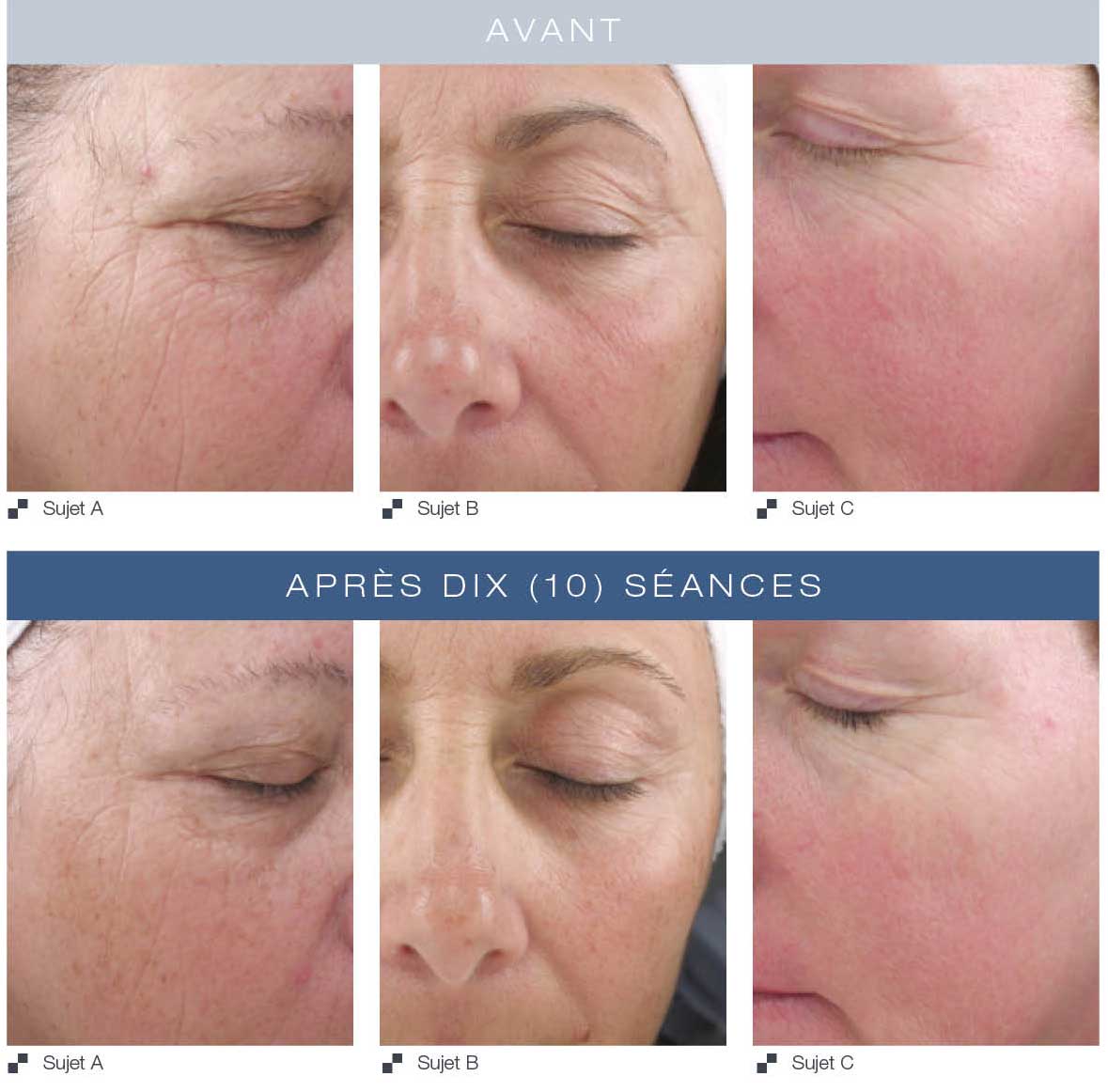 Soli-Lite - Silhouet-Tone